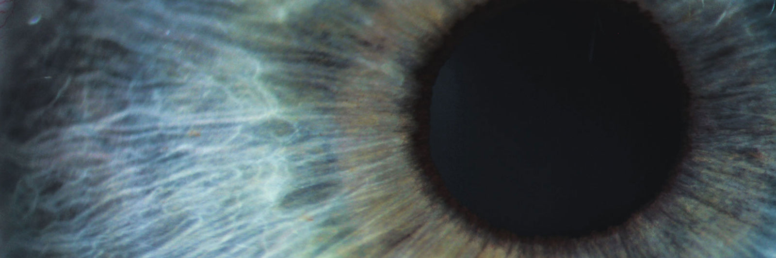 optomap® Retinal Imaging – Richmond Centre Optometry