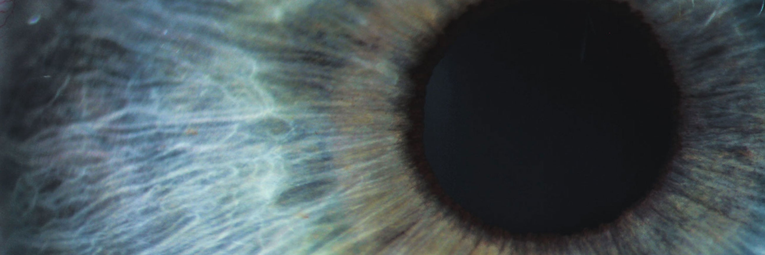 optomap® Retinal Imaging – Richmond Centre Optometry