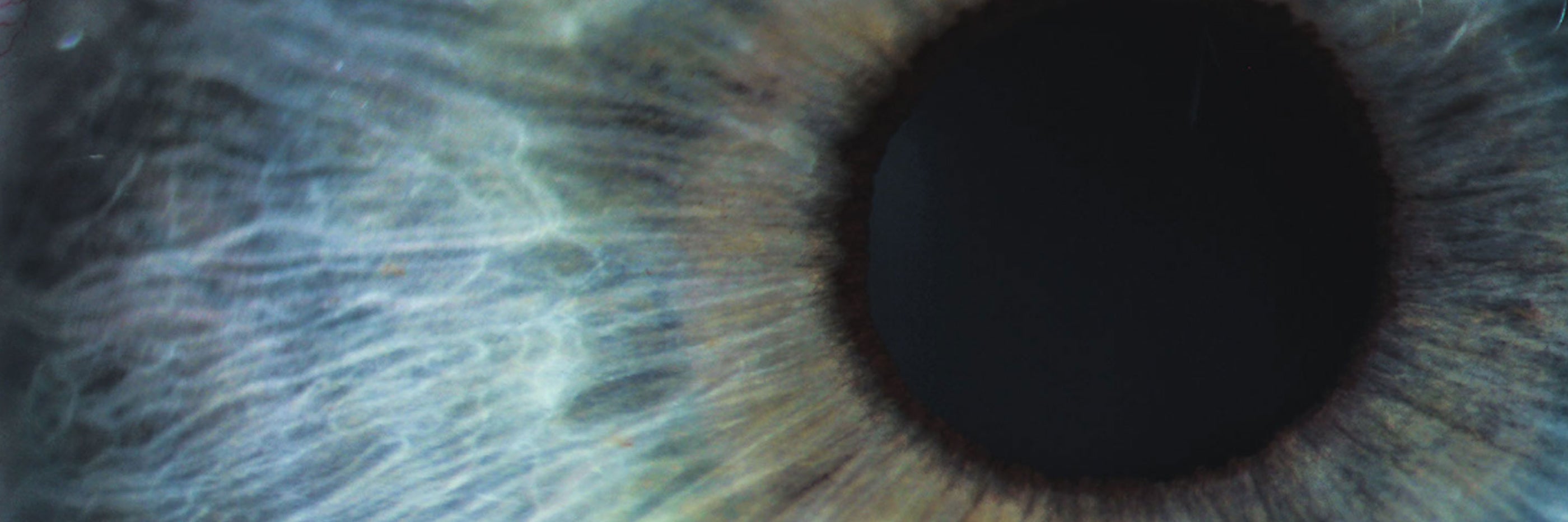 optomap® Retinal Imaging – Richmond Centre Optometry